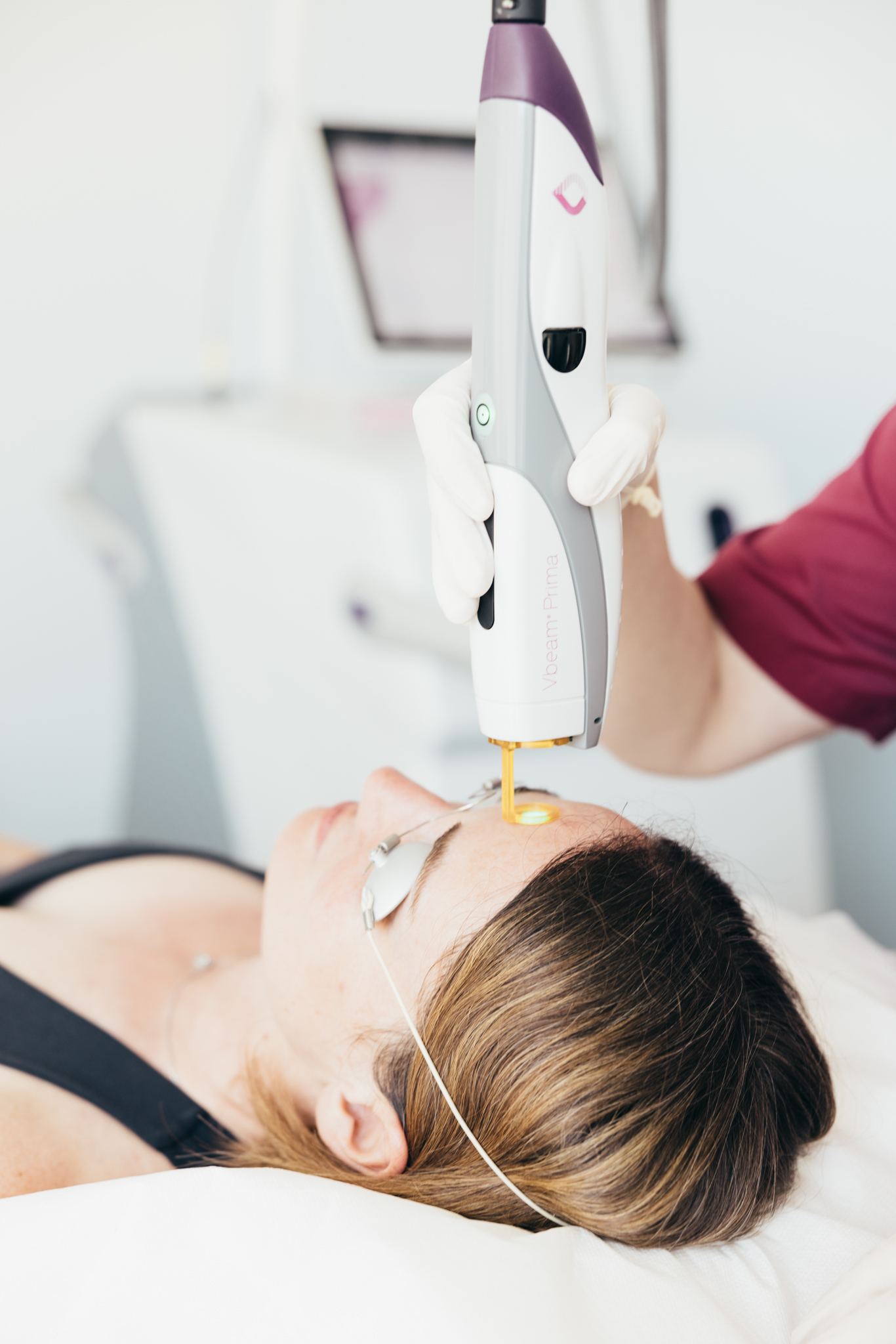 Laser vasculaire jambes & corps, érythrose | Forever Institut