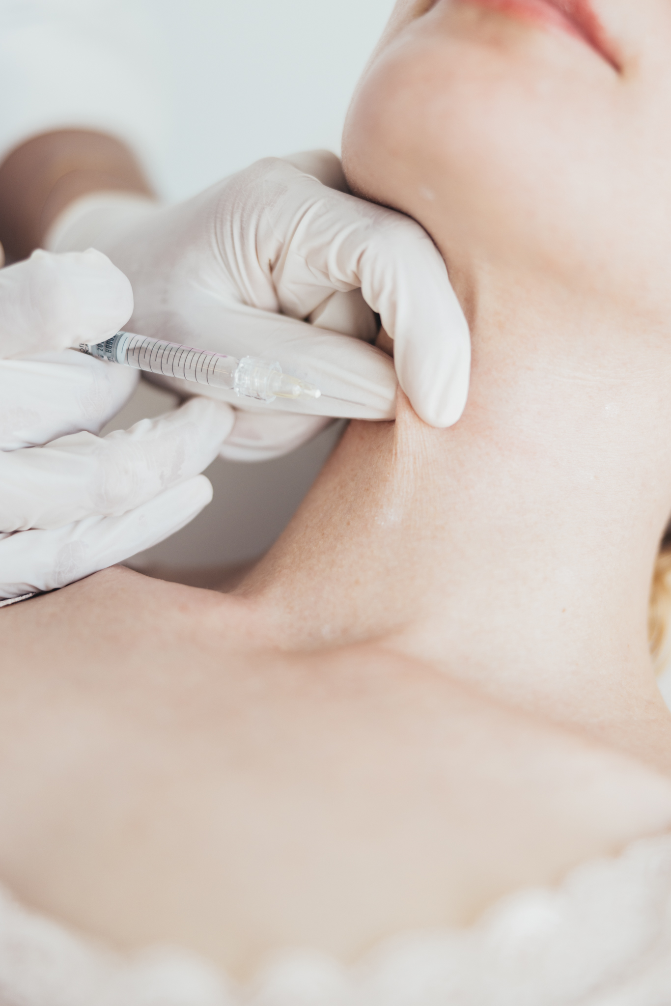 Profhilo Skin & Face injections in Geneva, Nyon and Lausanne | Forever ...